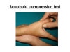 주상골 골절scaphoid Fracture 넘어진 뒤에 엄지 손가락 쪽 손목이 아파요 네이버 블로그